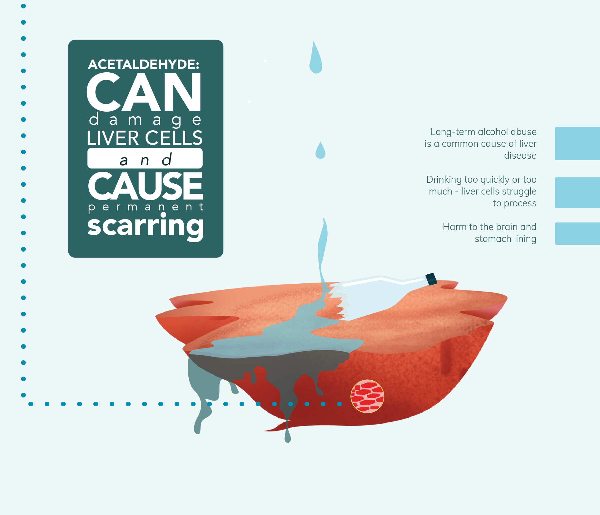 Alcohol´s journey through the body – Alcohol Awareness